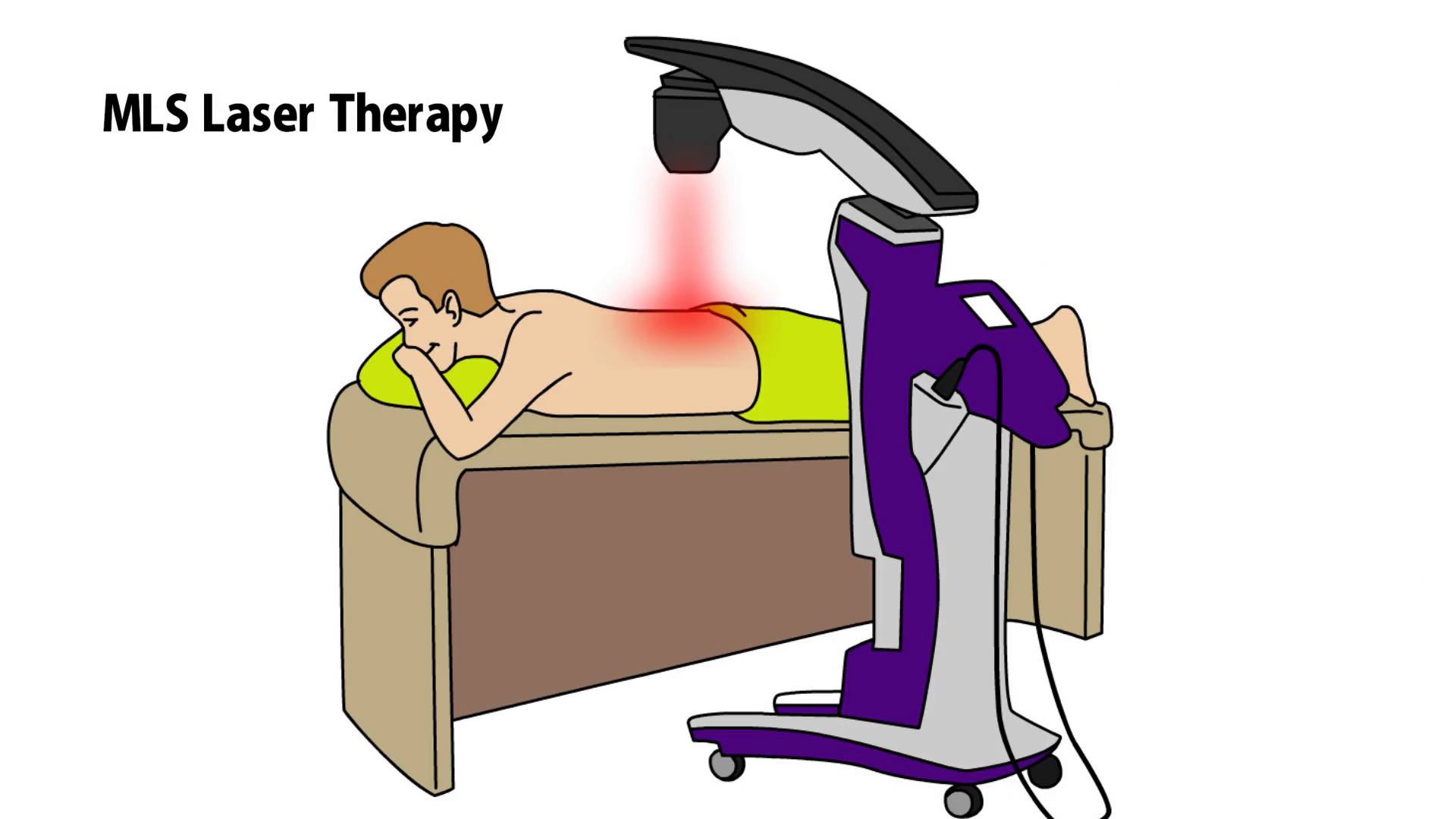 Overview of MLS Laser Therapy - Cutting Edge Lasers