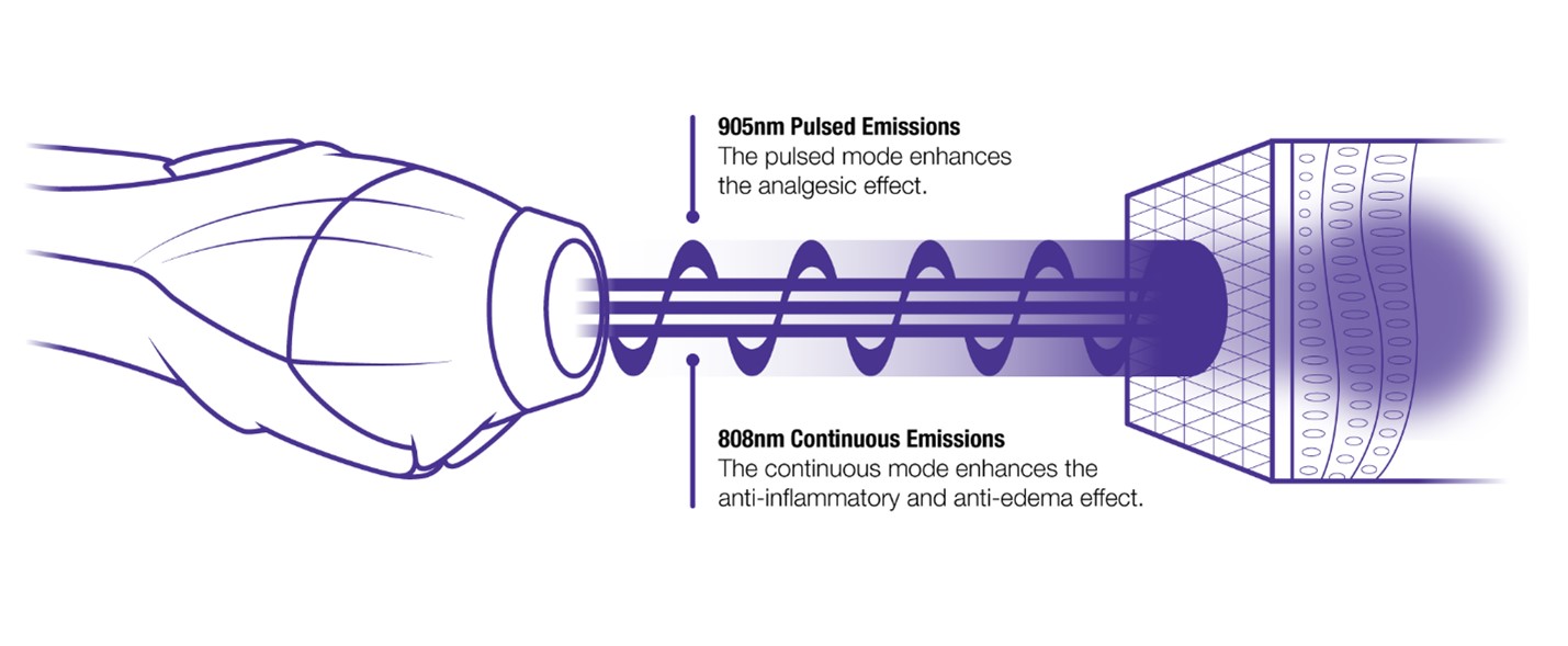 Back to the Basics: Multiwave Locked System (MLS®) Laser Therapy ...
